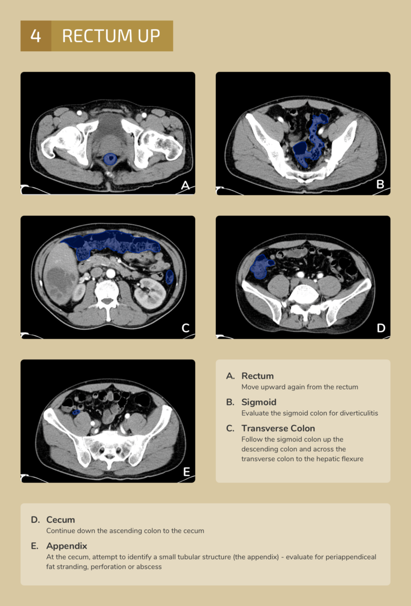 Differential Diagnosis of Infographic: CT Abdomen/Pelvis Interpretation