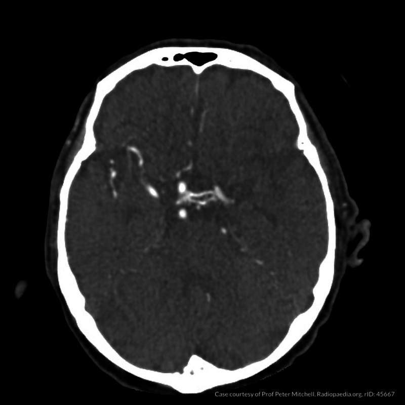 03_mca - Differential Diagnosis of