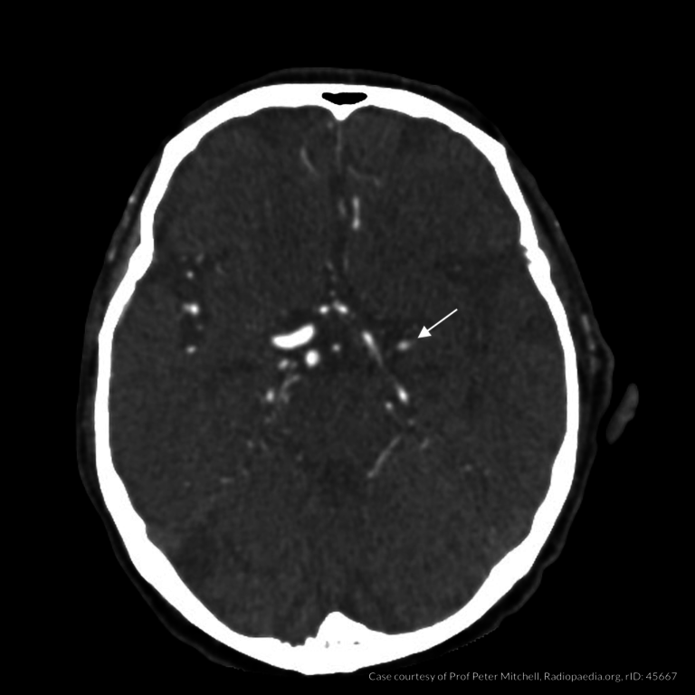 05_mca - Differential Diagnosis of