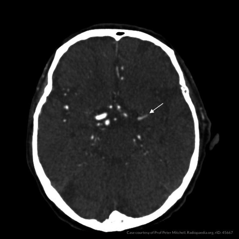 06_mca - Differential Diagnosis of