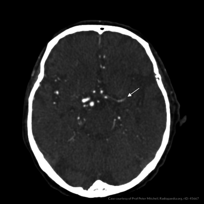 07_mca - Differential Diagnosis of