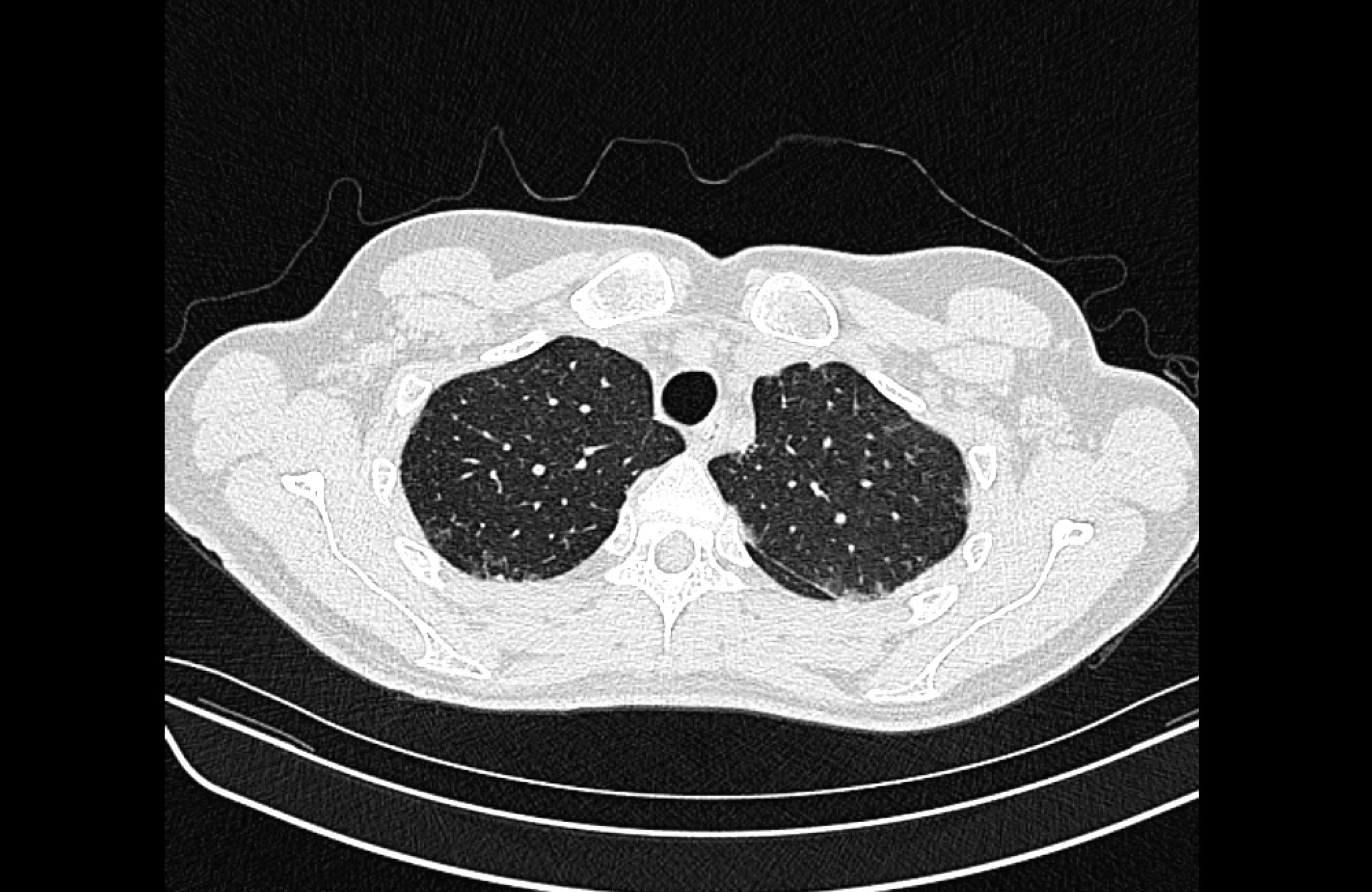 ct1_1 - Differential Diagnosis of