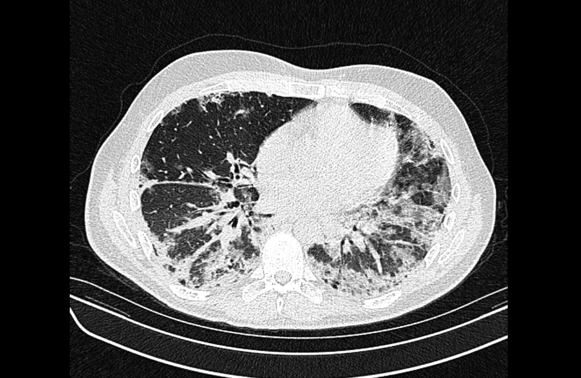 ct1_10 - Differential Diagnosis of