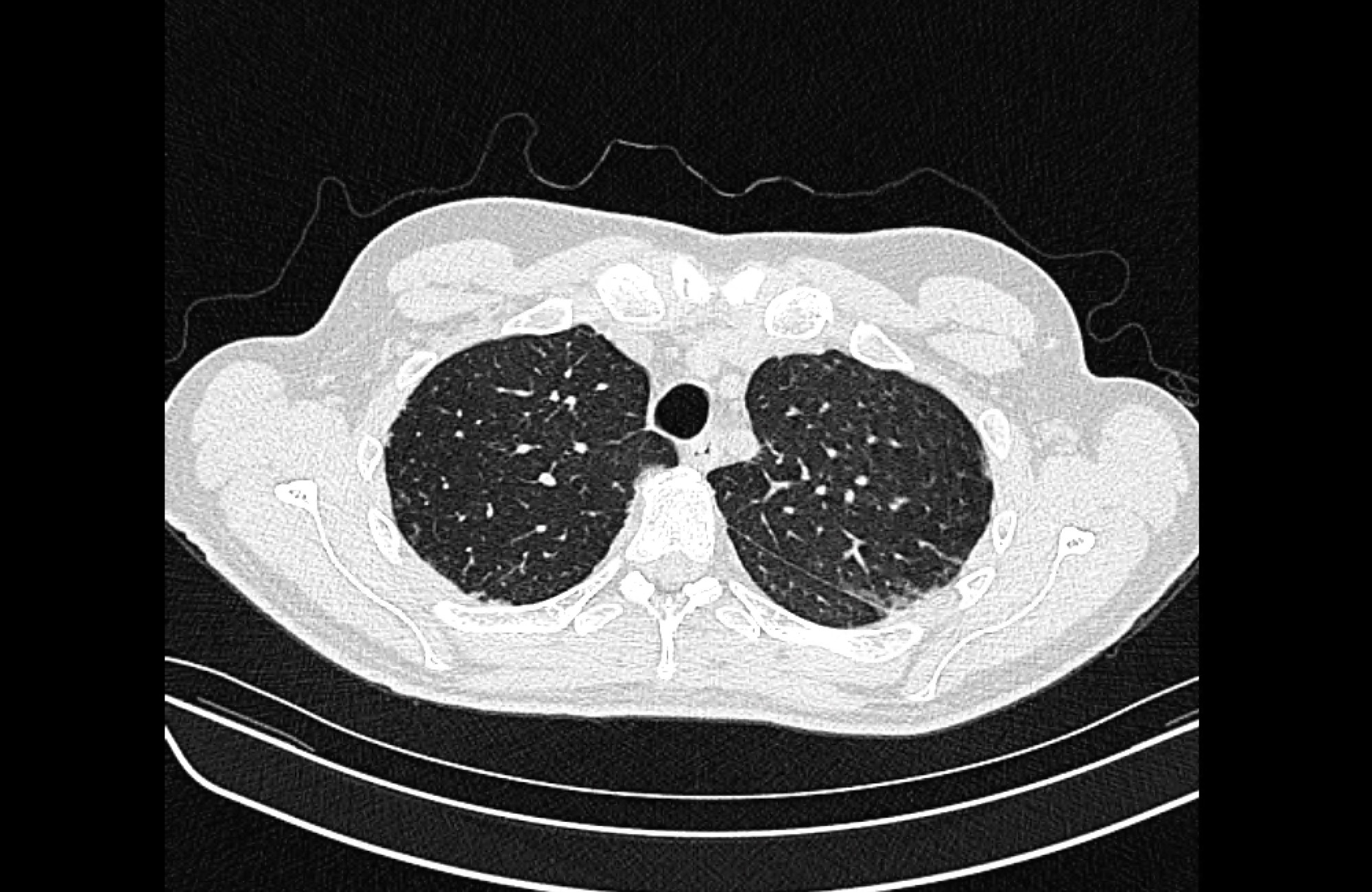ct1_2 - Differential Diagnosis of