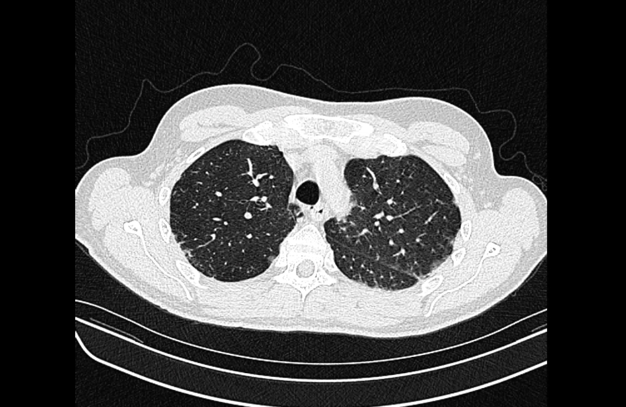 ct1_3 - Differential Diagnosis of