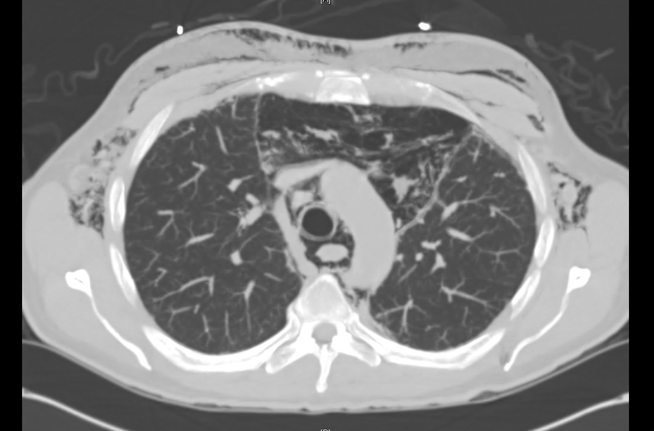 ct2_12 - Differential Diagnosis of
