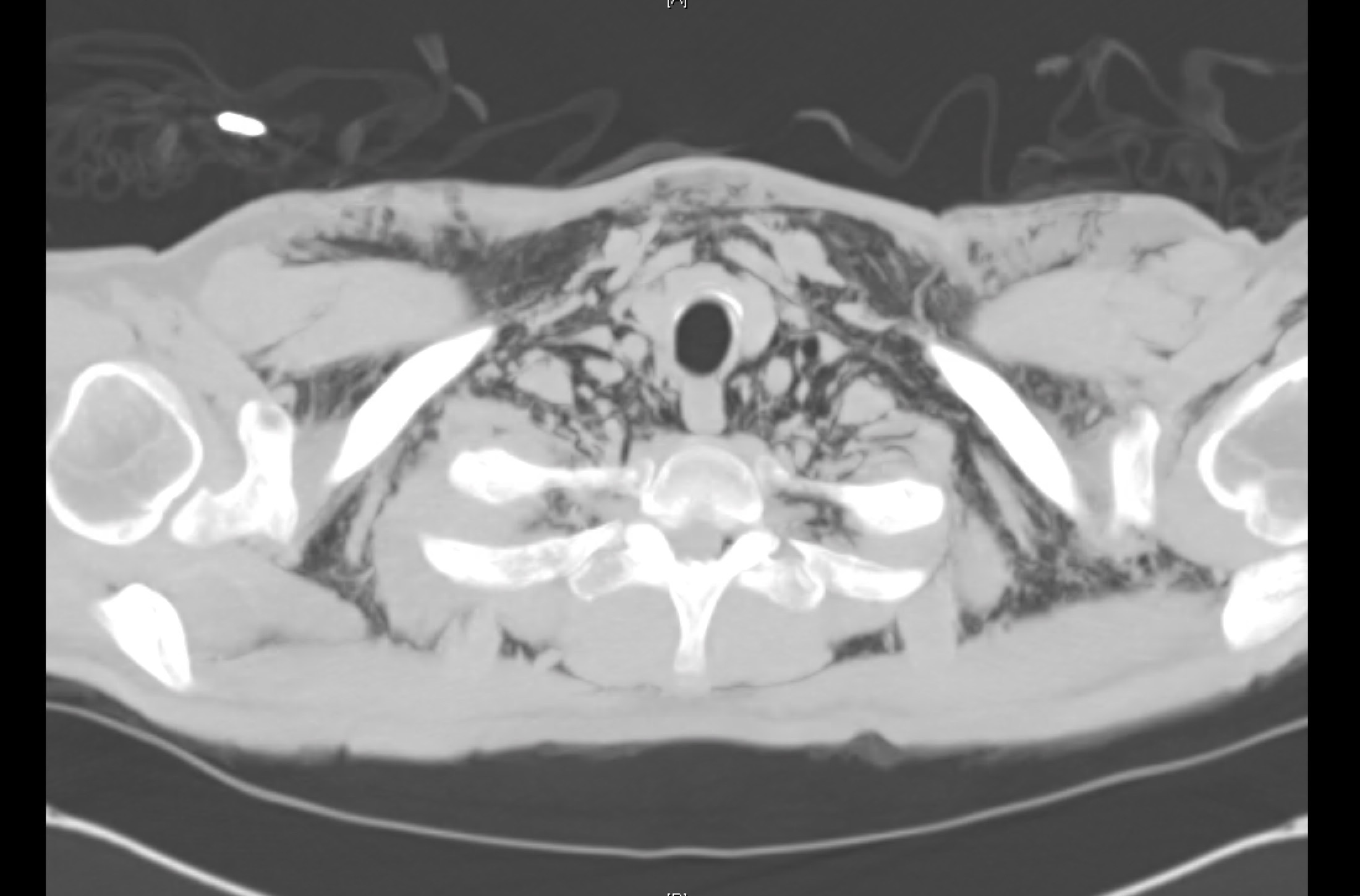 ct2_2 - Differential Diagnosis of