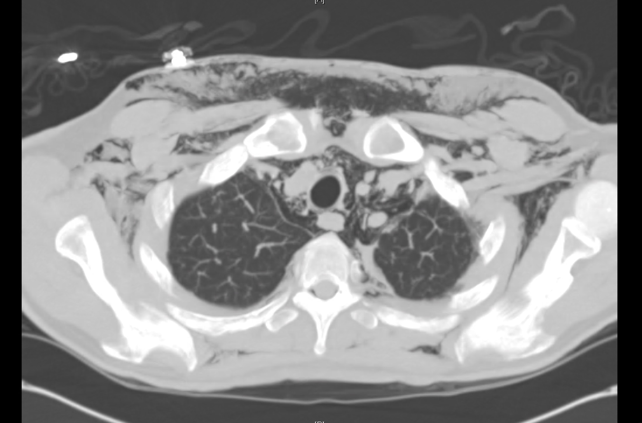 ct2_6 - Differential Diagnosis of