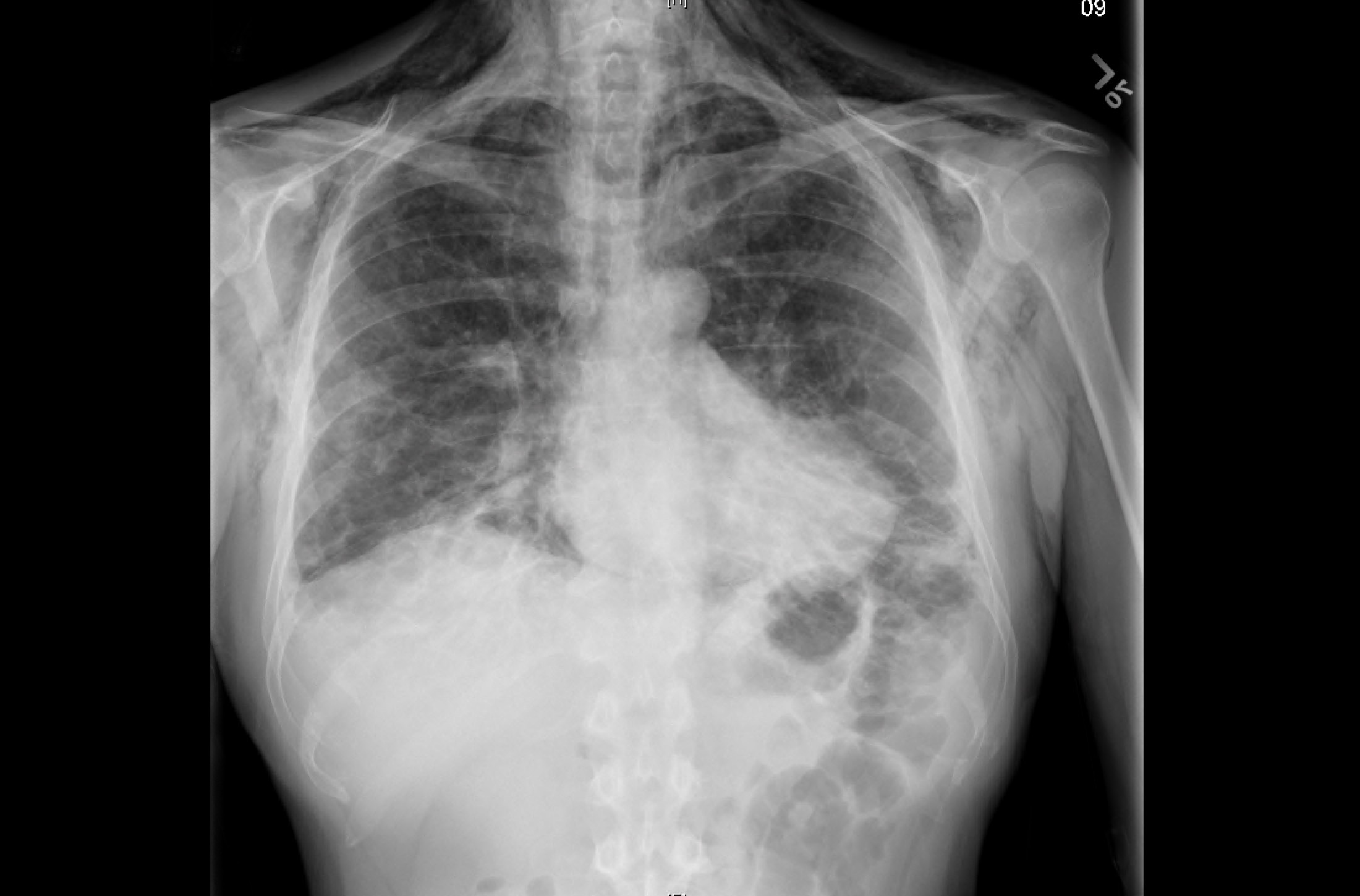 xr_1 - Differential Diagnosis of