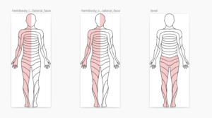 dermatome - Differential Diagnosis of