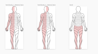 dermatome - Differential Diagnosis of