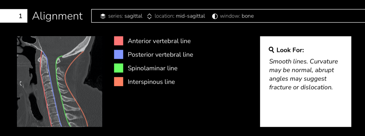 Differential Diagnosis of Infographic: CT Cervical Spine Interpretation