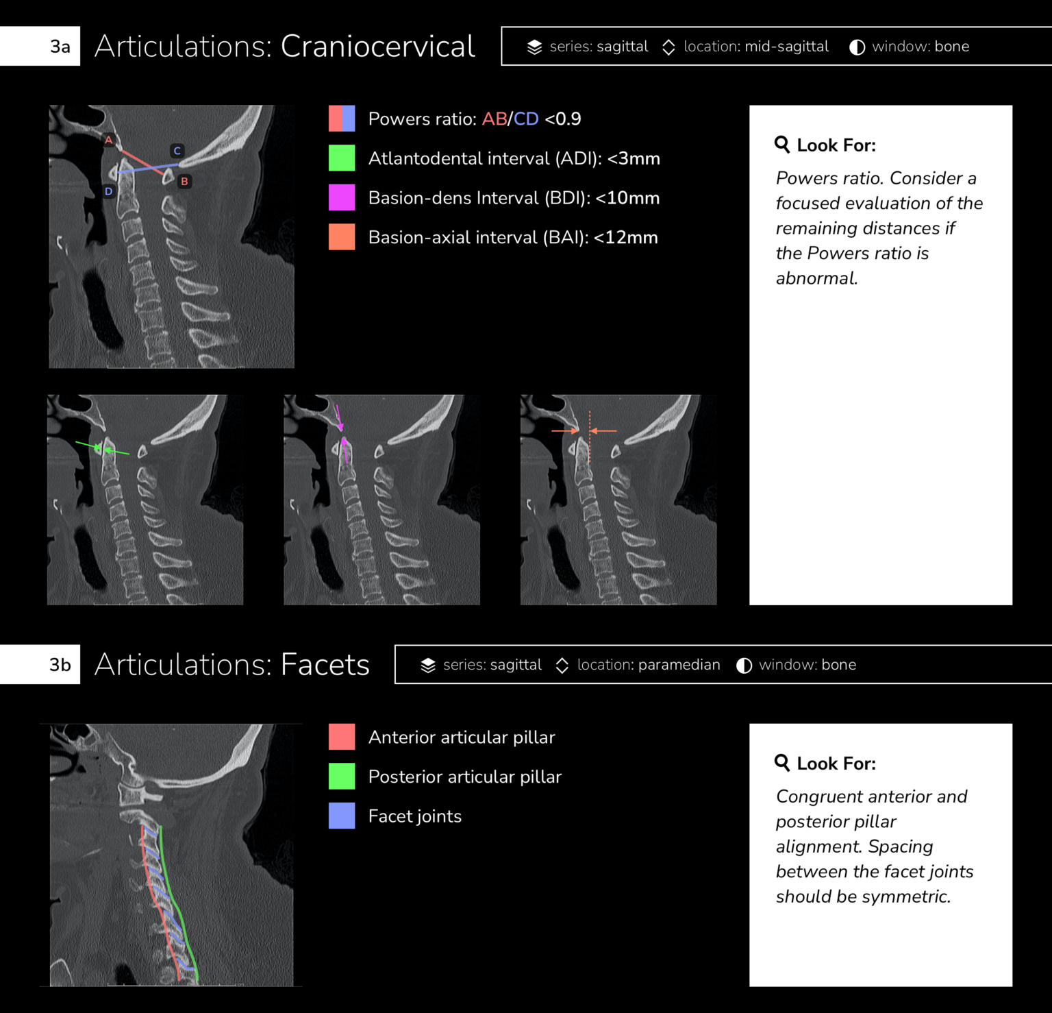 Differential Diagnosis of Infographic: CT Cervical Spine Interpretation