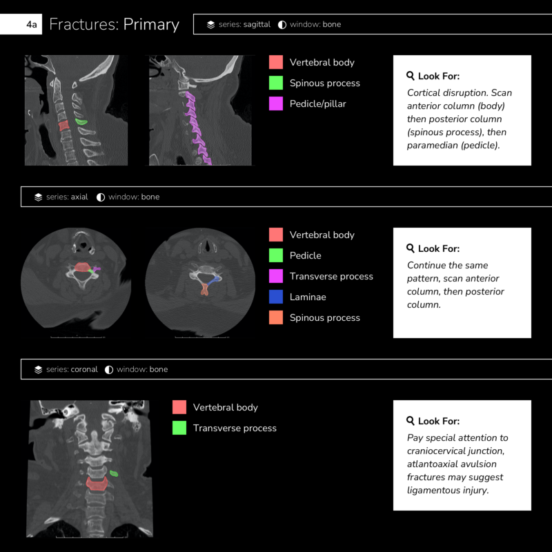 Differential Diagnosis of Infographic: CT Cervical Spine Interpretation