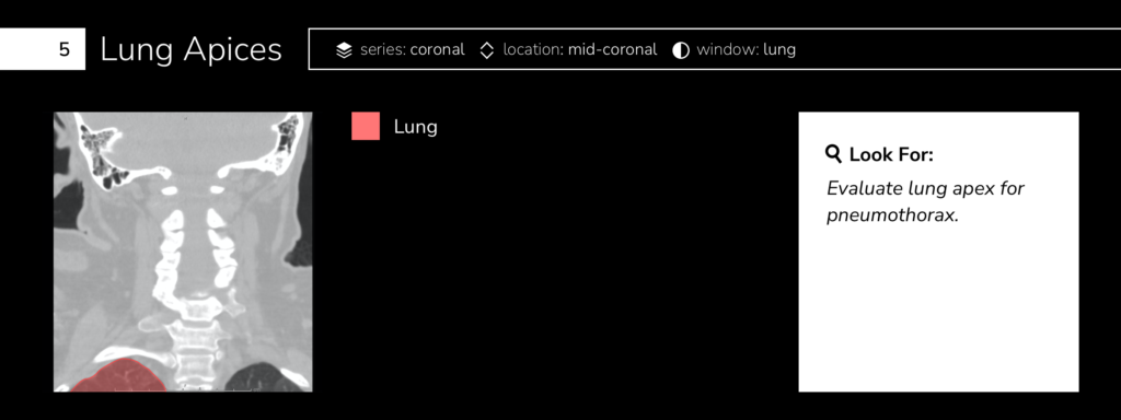 Lung Apices - Differential Diagnosis of
