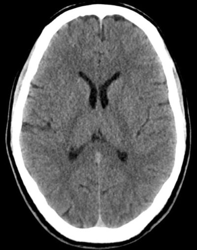 09_normal - Differential Diagnosis of