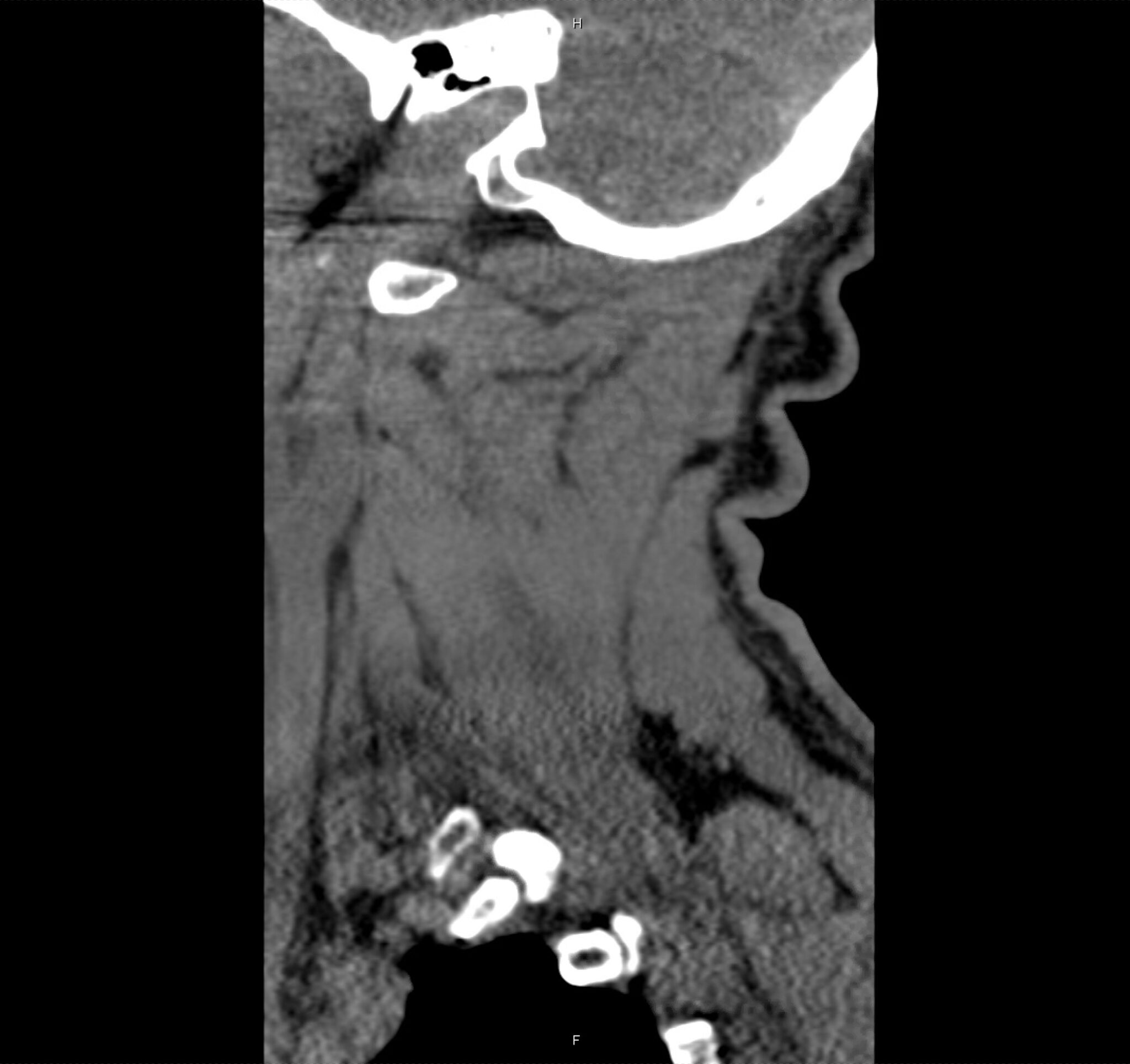 05 - Differential Diagnosis of