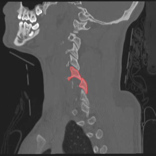 pathological_facet - Differential Diagnosis of