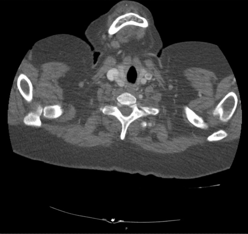 03_dissection-a - Differential Diagnosis of