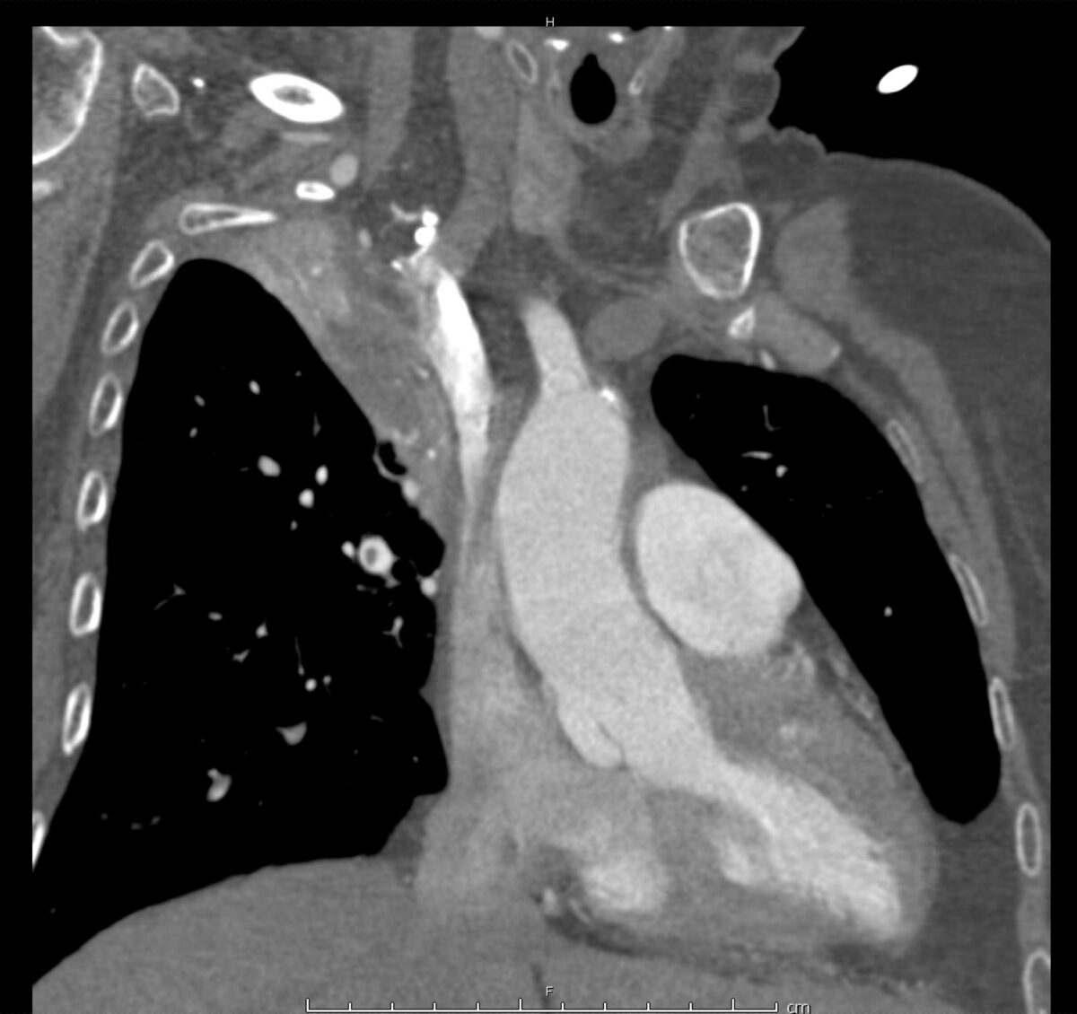 03_pe - Differential Diagnosis of