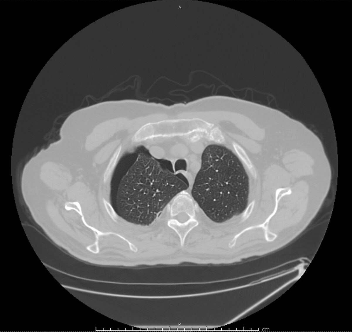 07_ptx - Differential Diagnosis of