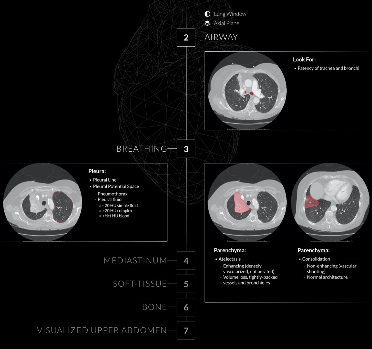 ct-chest-airway - Differential Diagnosis of