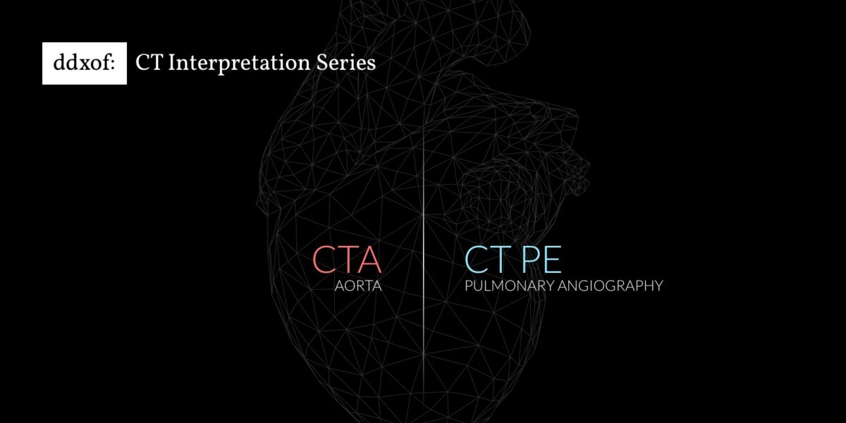 ct-chest-header - Differential Diagnosis of